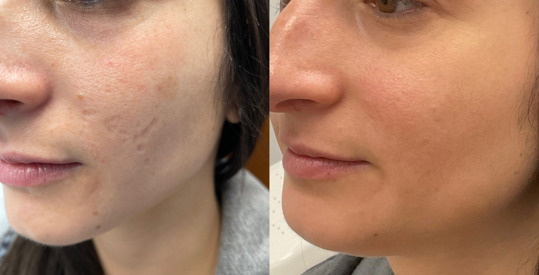 Scar Repair: Restore and Revitalize | Dr. Kally Papantoniou