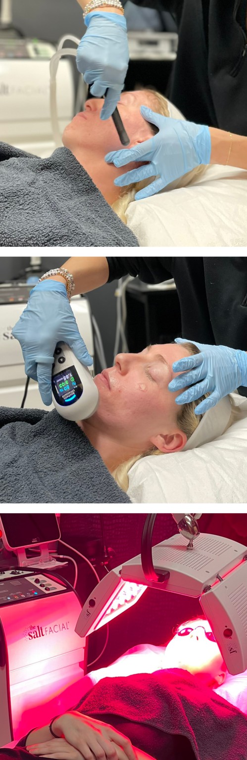 The Complete Guide to the Salt Facial at Simply Derm | Dr. Kally ...