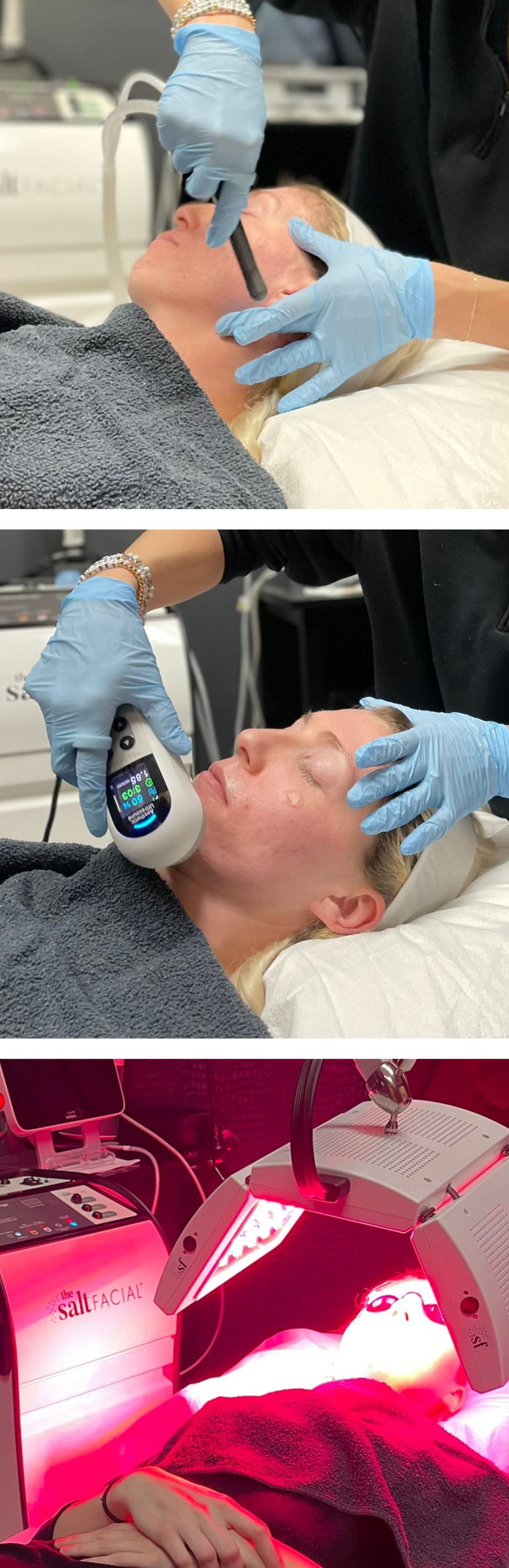 The Complete Guide to the Salt Facial at Simply Derm | Dr. Kally ...