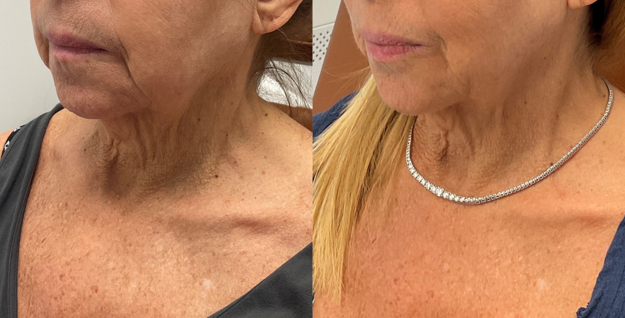 Skin Revitalization | Dr. Kally Papantoniou
