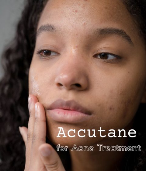 Accutane for Acne Treatment | Dr. Kally Papantoniou