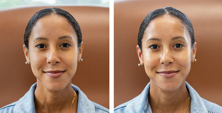 The Complete Guide to the Salt Facial at Simply Derm | Dr. Kally ...